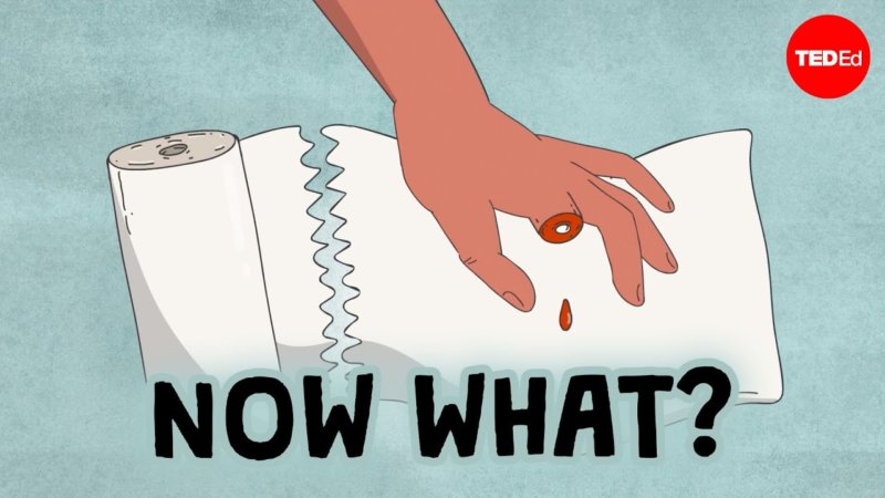What should you do if you accidentally cut off your finger? – Jason ...